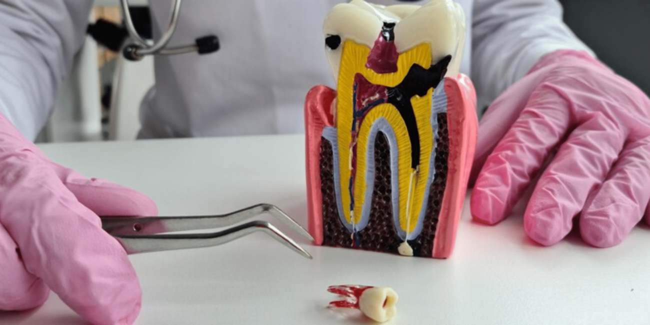 Root Canal Aftercare: 5 Effective Tips for Speedy Recovery